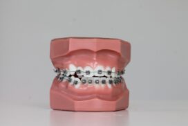 Soorten beugels | Ortho aan de Zaan